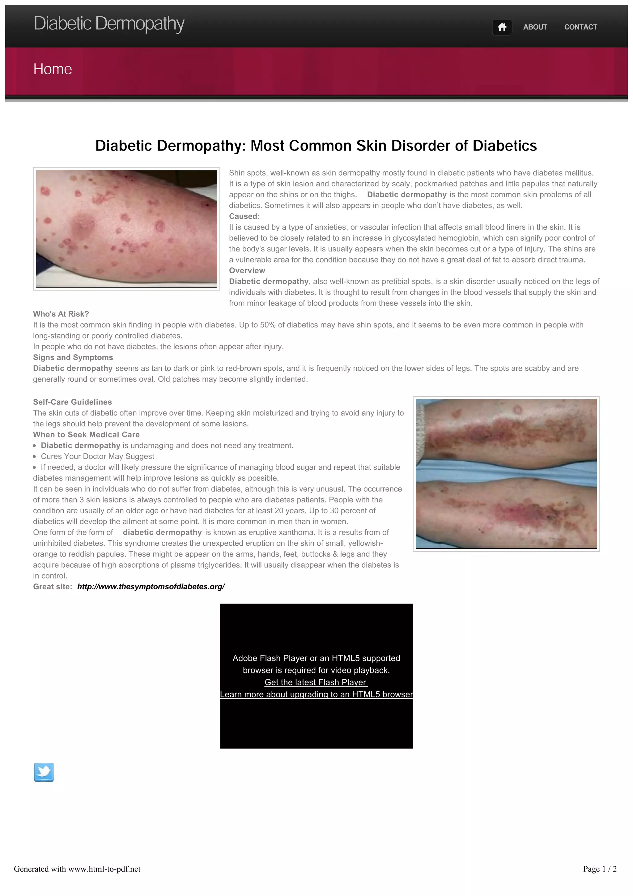 Diabetic Dermopathy: Most Common Skin Disorder of Diabetics | PDF