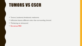 Central Serous Chorioretinopathy- Case Presentation by Toqua Saflo | PPTX