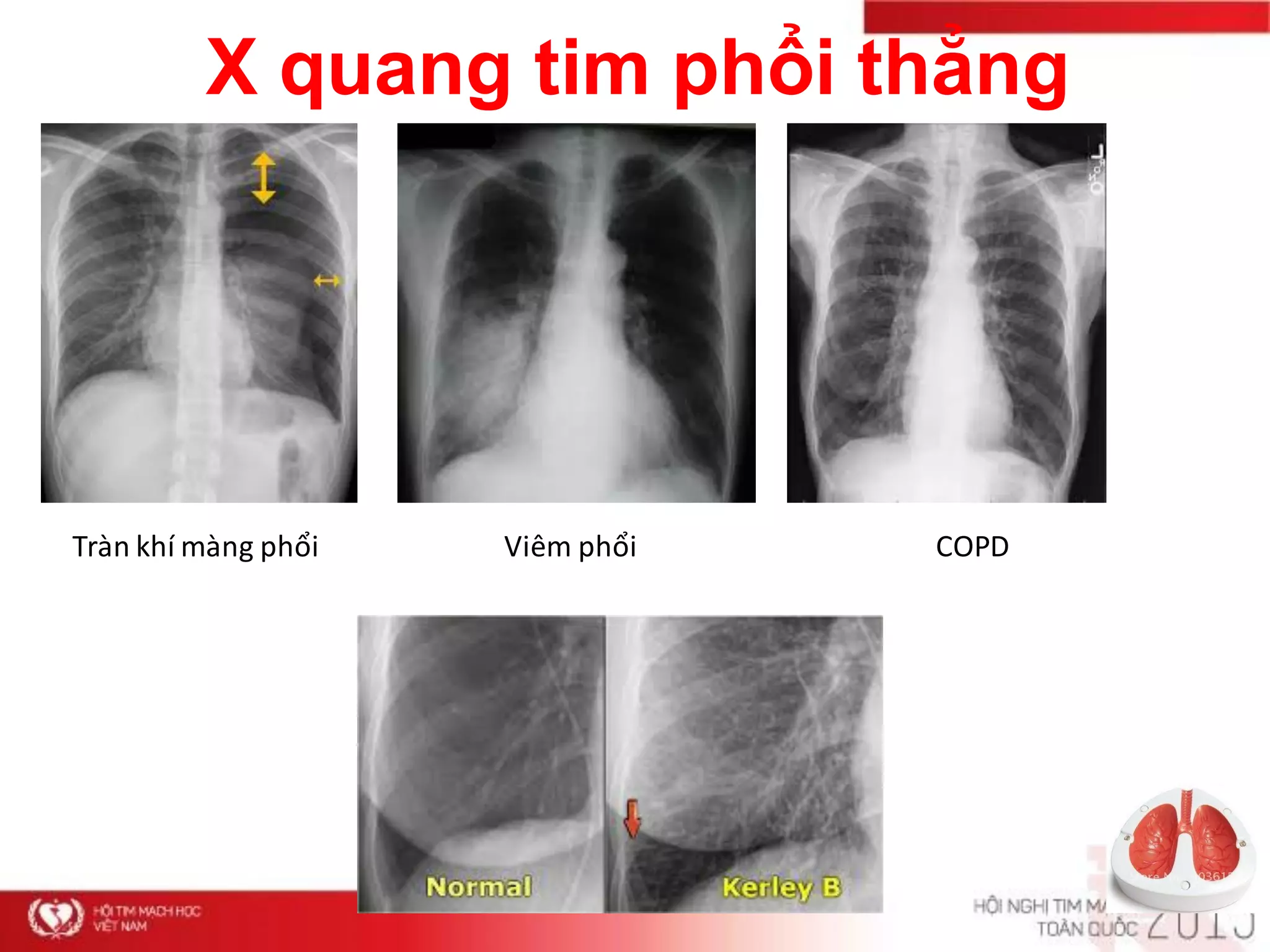 File_hn2015_E011-BS-Dat-Tiep-can-BN-Kho-tho 2.pdf