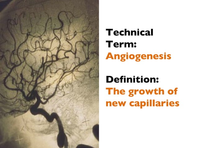 The Brain Training Revolution | PPT