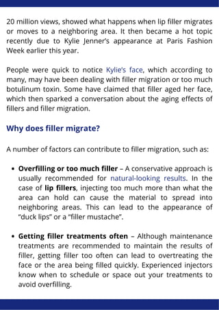Filler Migration What is it and Why is it Trending.pdf