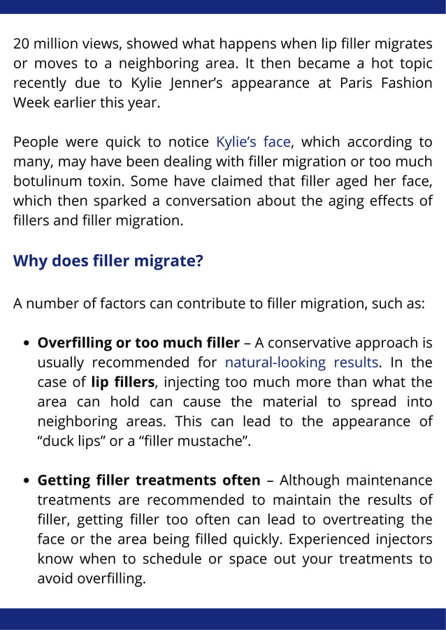 Filler Migration What is it and Why is it Trending.pdf