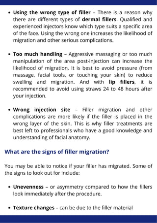 Filler Migration What is it and Why is it Trending.pdf