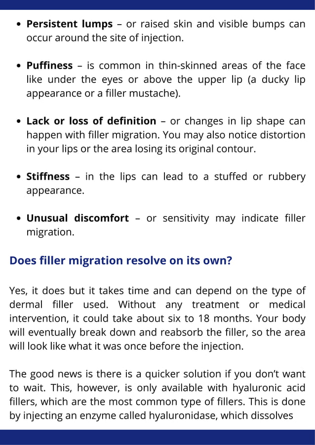 Filler Migration What is it and Why is it Trending.pdf