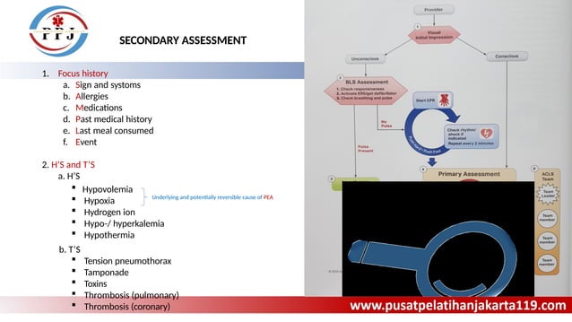 FILOSOFI ACLS ASSSSSSSSSSSSSSSSSSSSS.pptx