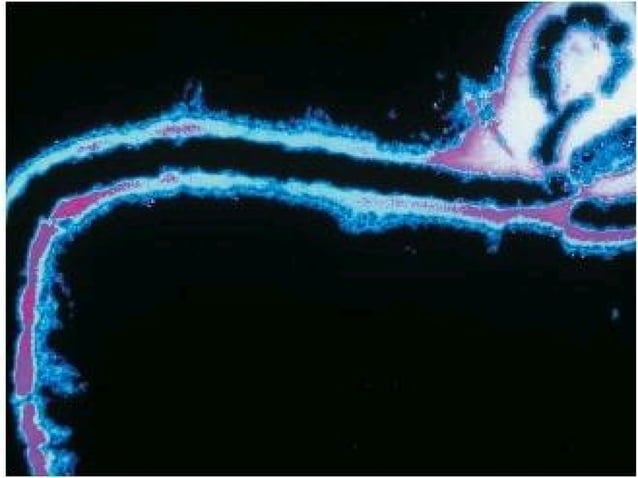 Filoviridae | PPT | Infectious Diseases | Diseases and Conditions
