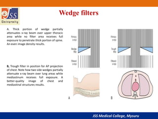 Filters and beam restrictors | PPTX