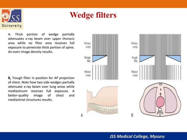 Filters and beam restrictors | PPTX