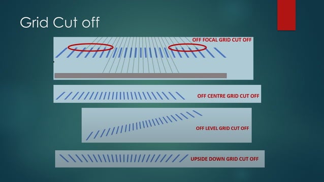 Filters and Grids - Radiology Physics.pptx