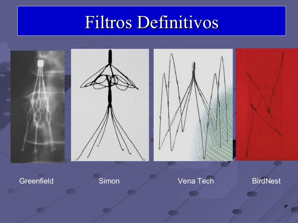 Filtro de vena cava