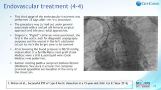 First in man endovascular treatementaodinchildrenbec-2017 [autosaved] | PPT