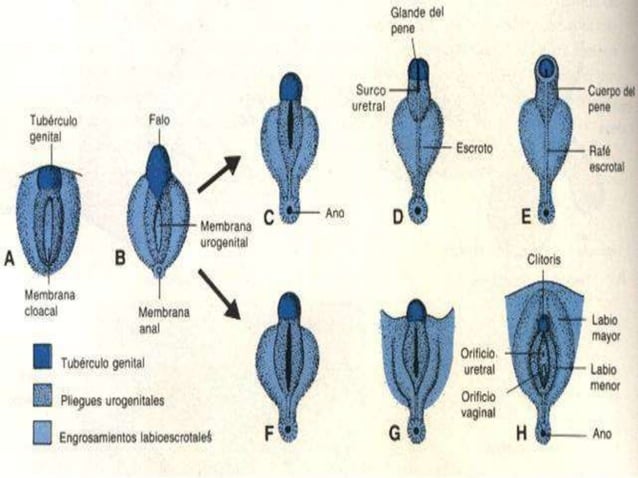 Fimosis