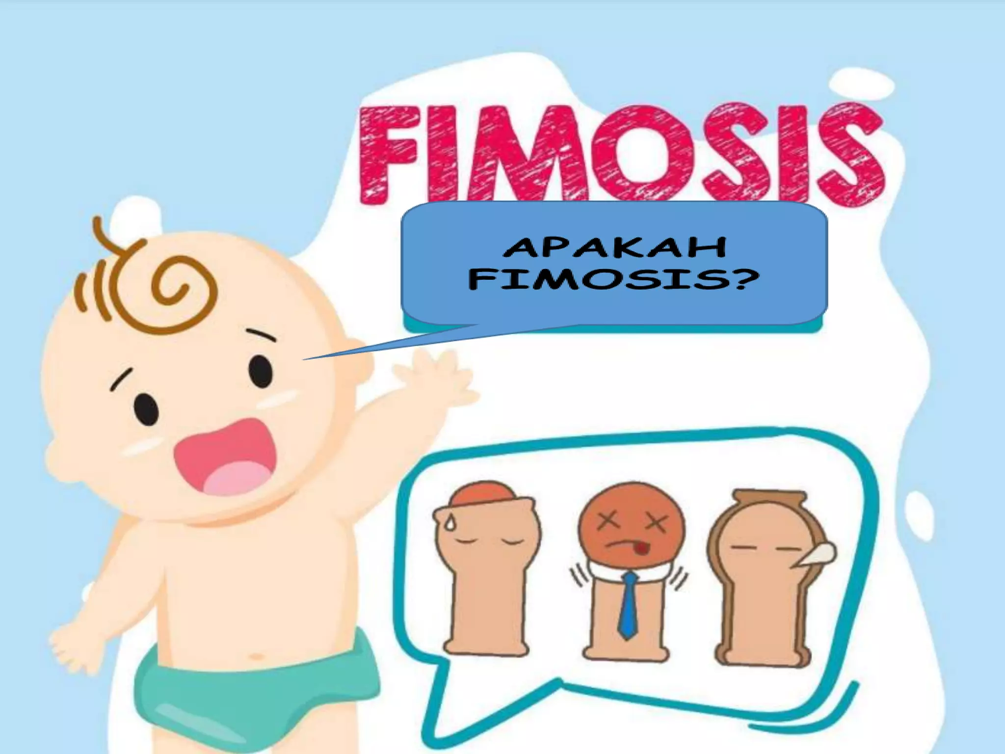 fimosis.pptx