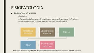 Fimosis parafimosis | PPTX