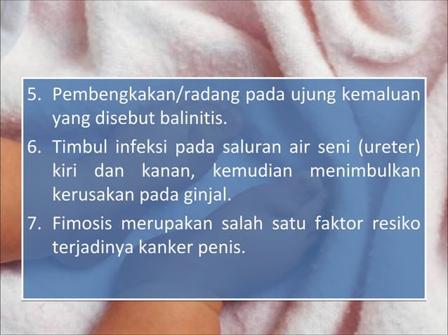 Fimosis NRA (etika, faizatun,faulivian) | PPT