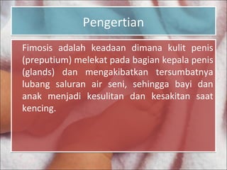 Fimosis NRA (etika, faizatun,faulivian) | PPT