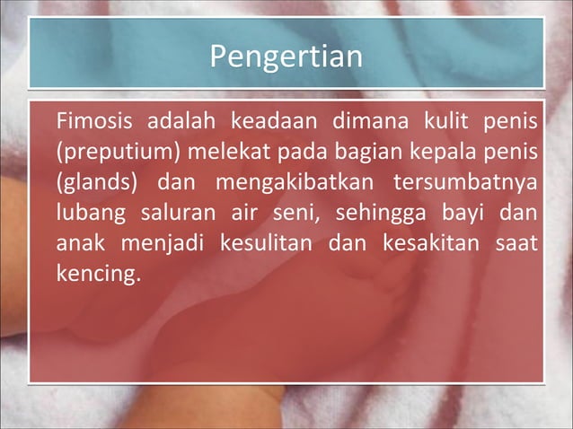 Fimosis NRA (etika, faizatun,faulivian) | PPT