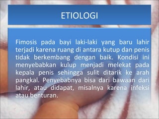 Fimosis NRA (etika, faizatun,faulivian) | PPT