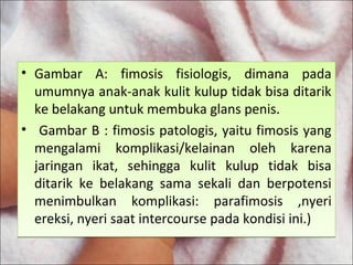 Fimosis NRA (etika, faizatun,faulivian) | PPT