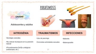 FIMOSIS, PARAFIMOSIS, PRIAPISMO. KARINA.pptx
