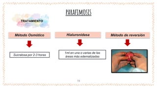 FIMOSIS, PARAFIMOSIS, PRIAPISMO. KARINA.pptx