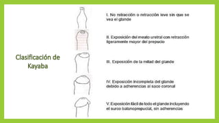 Fimosis y hernias | PPT