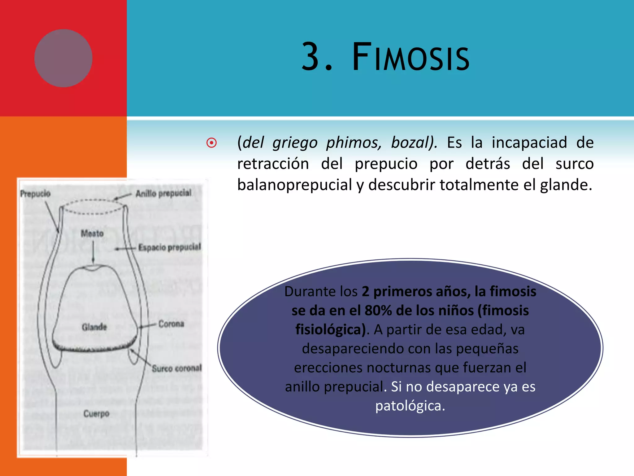Fimosis y parafimosis | PPTX