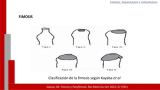 FIMOSIS Y PARAFIMOSIS. Medicina urologia | PPTX