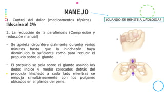 FIMOSIS_Y_PARAFIMOSIS.pptx presentación. | PPTX