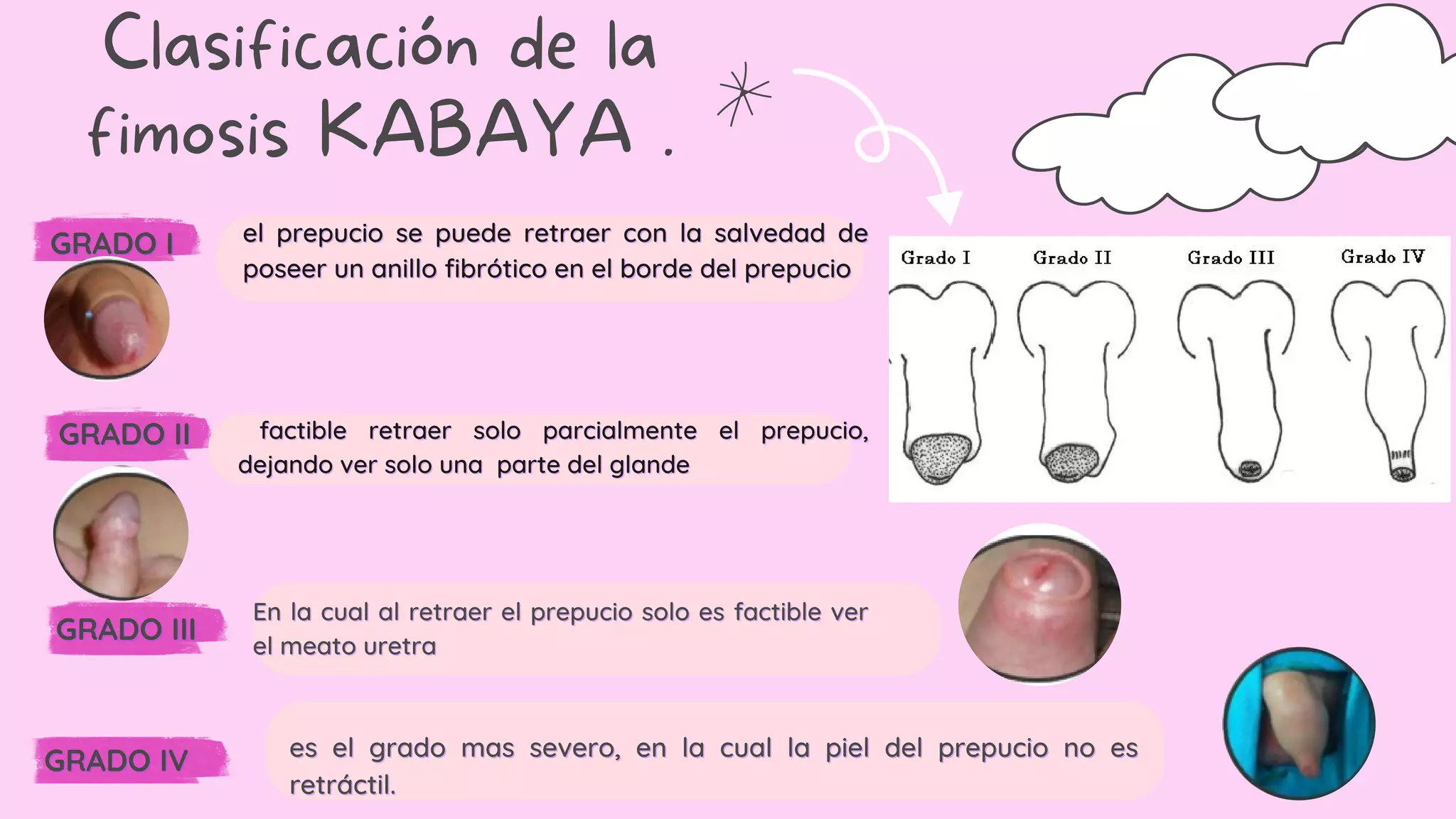 fimosis y parafimosis meily.pdf