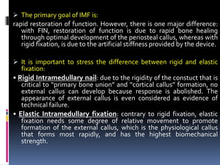 intramedullary fixation in children | PPTX