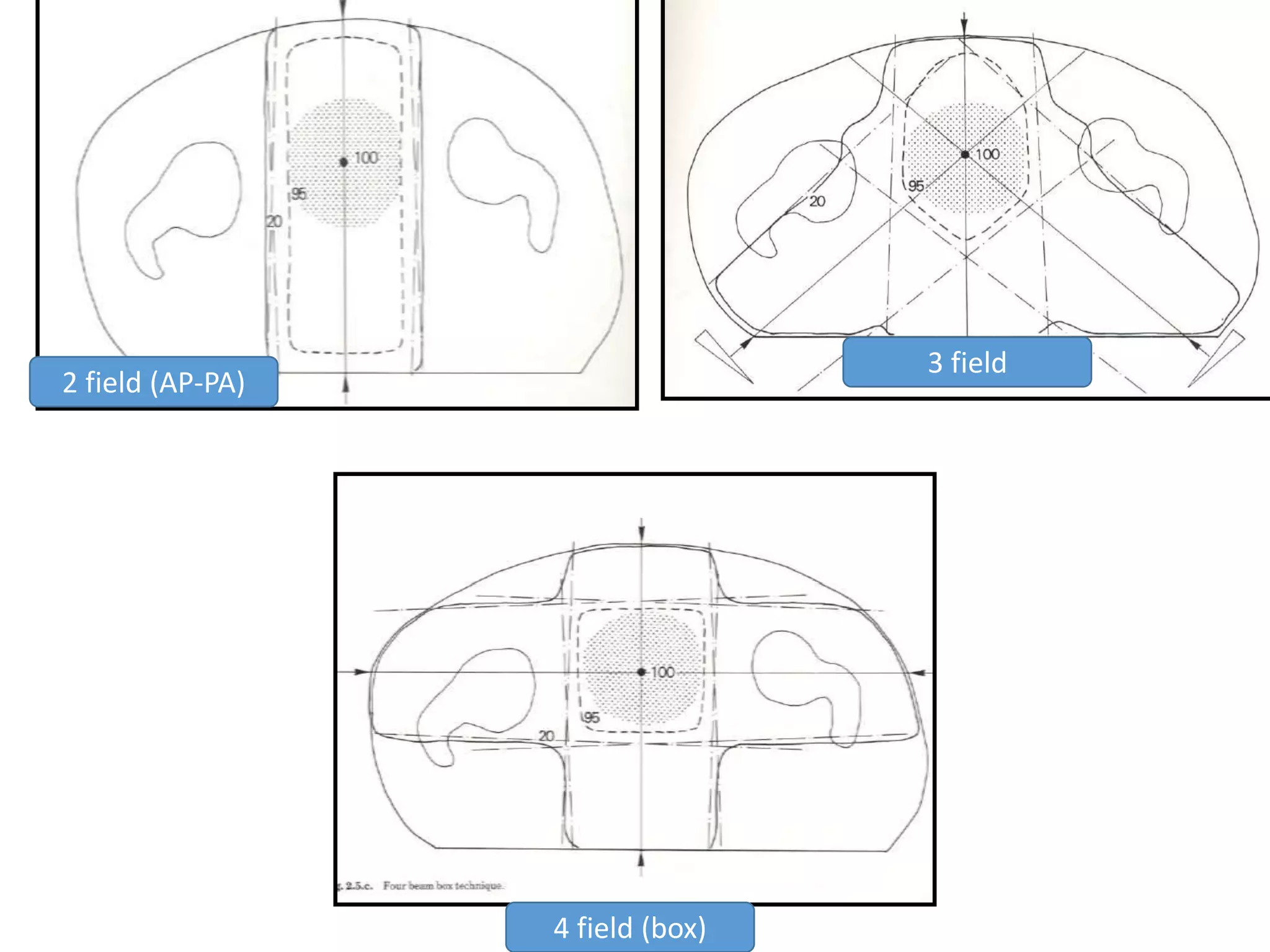 Final ICRU 62 ( International commission on radiation units and ...