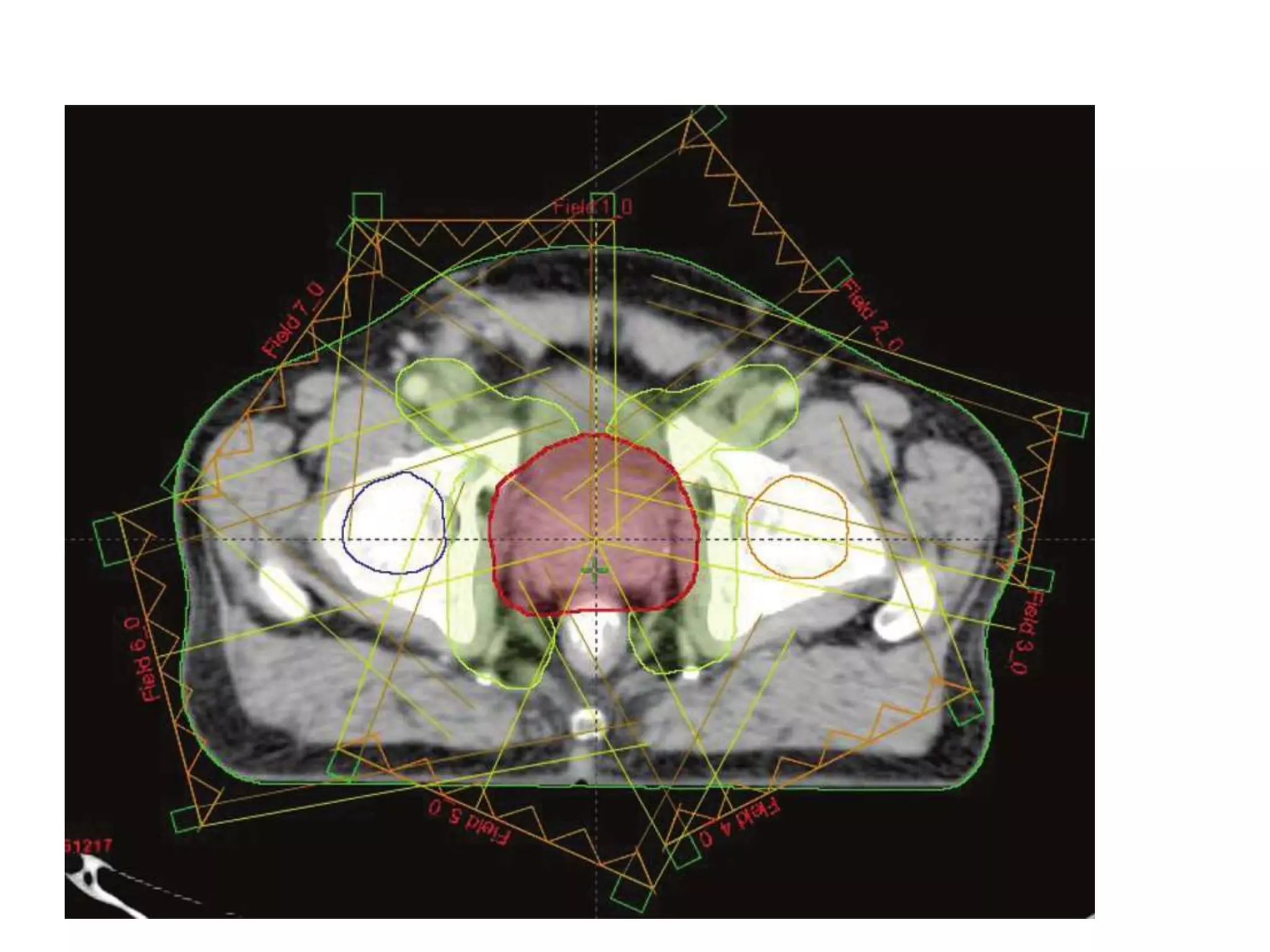 Final ICRU 62 ( International commission on radiation units and ...