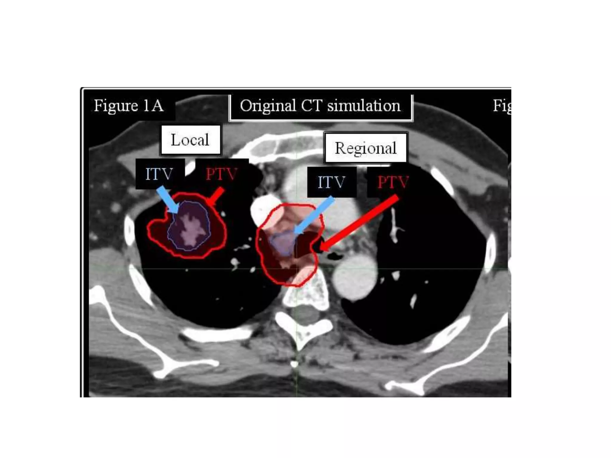 Final ICRU 62 ( International commission on radiation units and ...