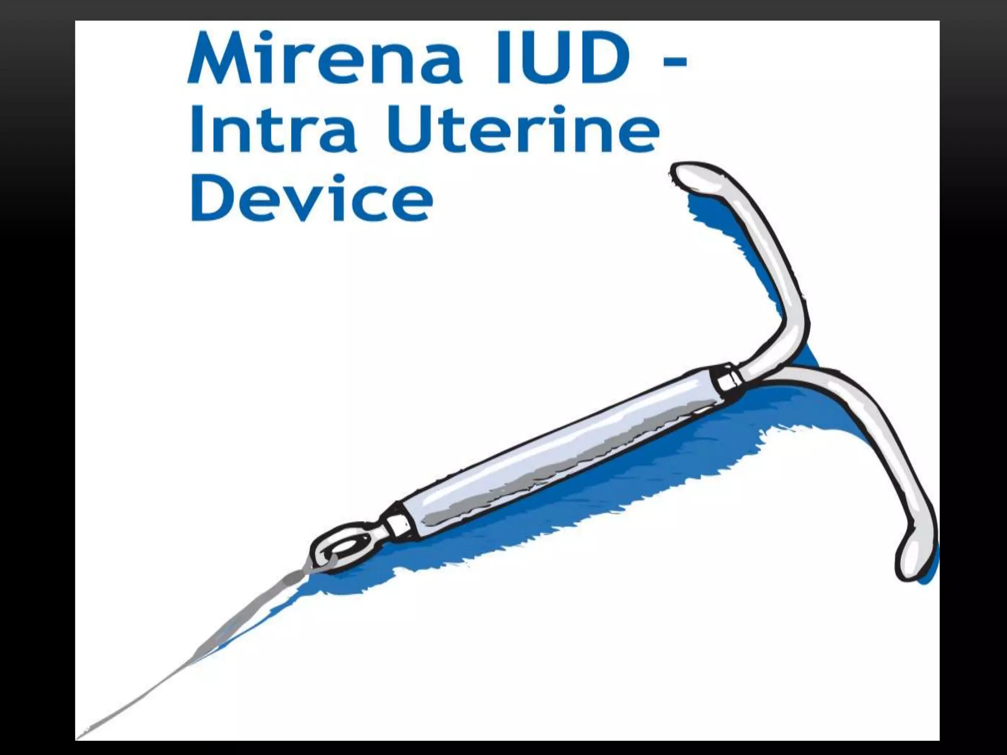 IUD | PPTX