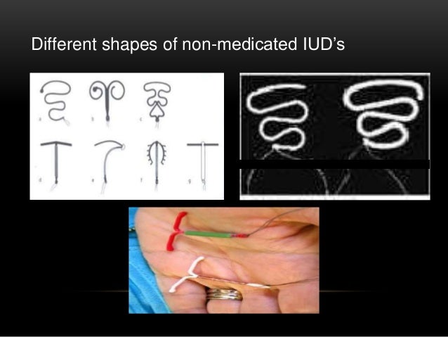 IUD