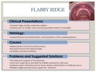 Mucosal Response To Oral Prostheses | PPTX