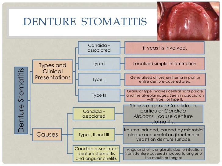 Mucosal Response To Oral Prostheses