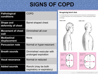 COPD | PPTX | Lung and Respiratory Health | Diseases and Conditions
