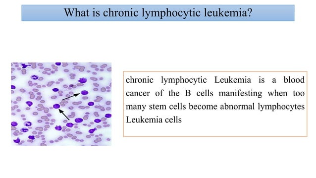 BCR | PPTX | Endocrine and Metabolic Diseases | Diseases and Conditions
