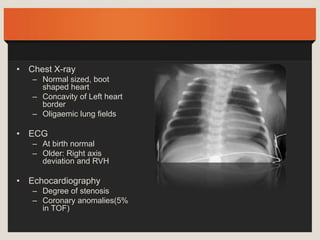 Approach to patient with congenital heart disease | PPT