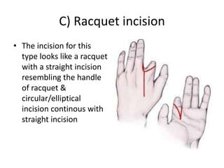 Gangrene & amputation | PPT