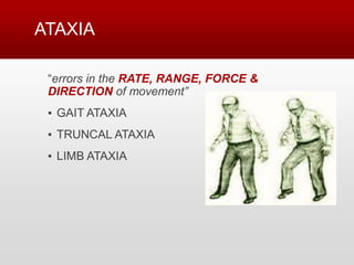 Ataxic Gait