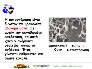 Τελευταίες διατροφικές συστάσεις για την οστεοπόρωση | PPT