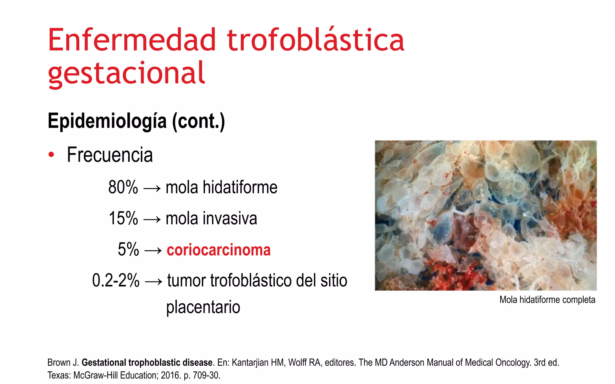 Coriocarcinoma, diagnóstico, seguimiento y tratamiento | PPT