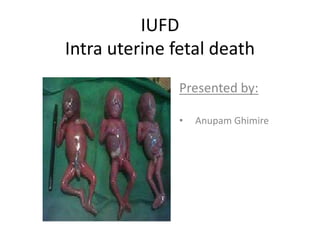 IUFD due to Intrahepatic cholestatsis of pregnancy | PPT