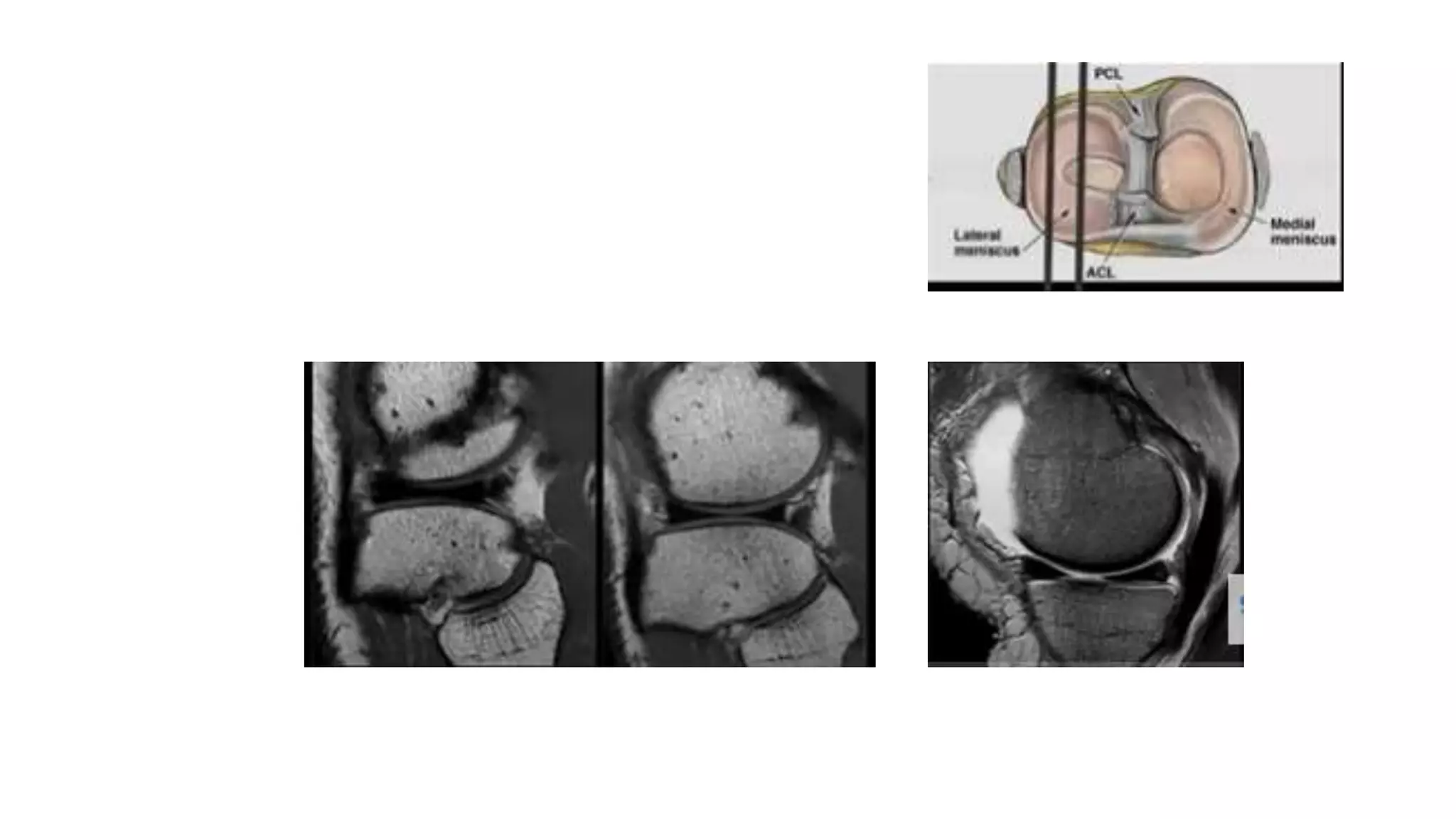 MRI PROCEDURE OF KNEE AND ANKLE JOINT | PPT