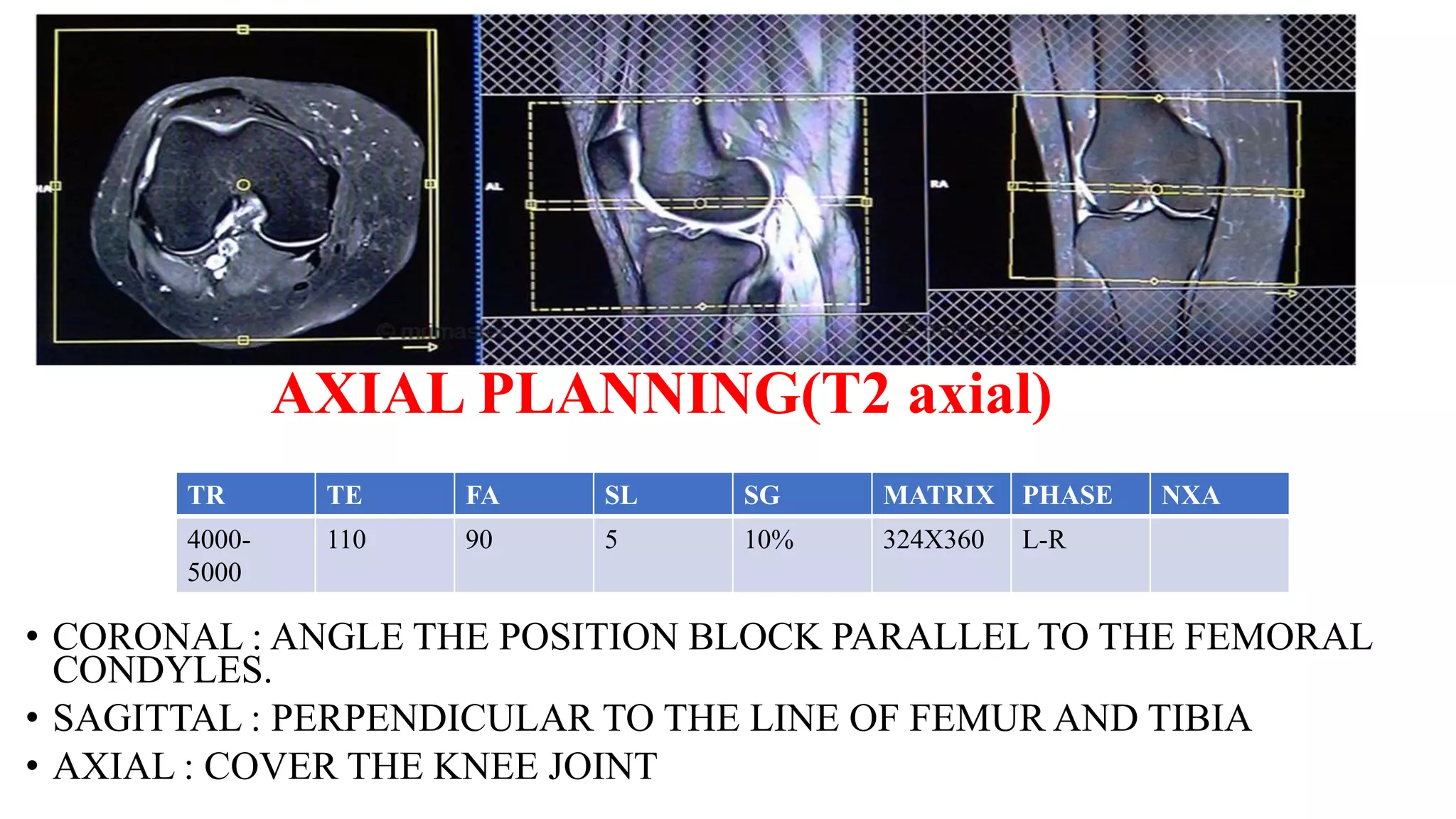 MRI PROCEDURE OF KNEE AND ANKLE JOINT | PPT