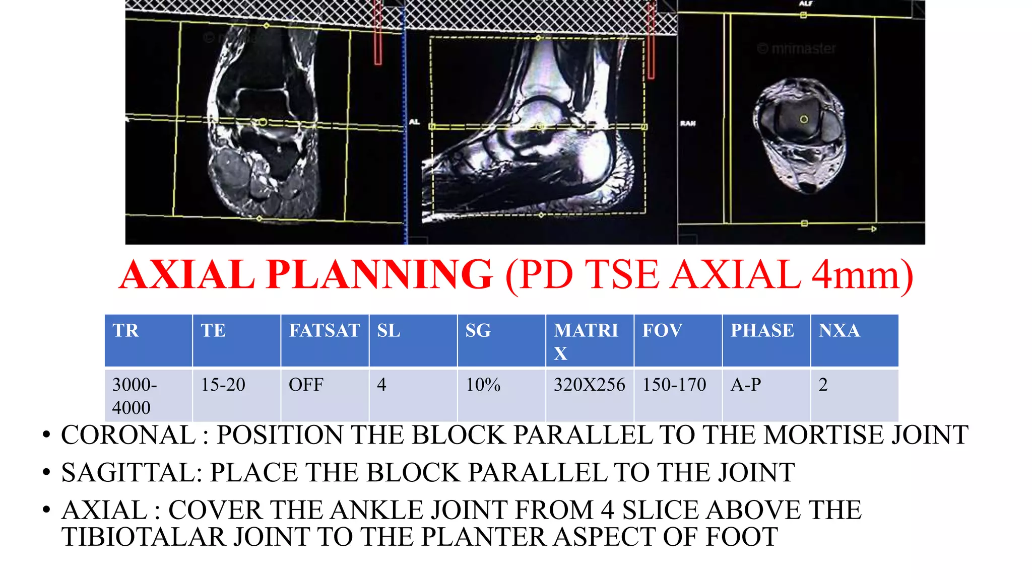 MRI PROCEDURE OF KNEE AND ANKLE JOINT | PPT