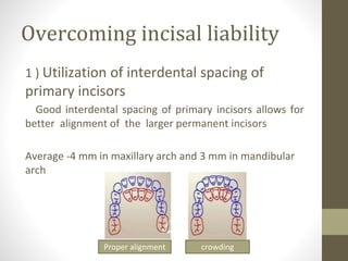 Development of occlusion | PPT